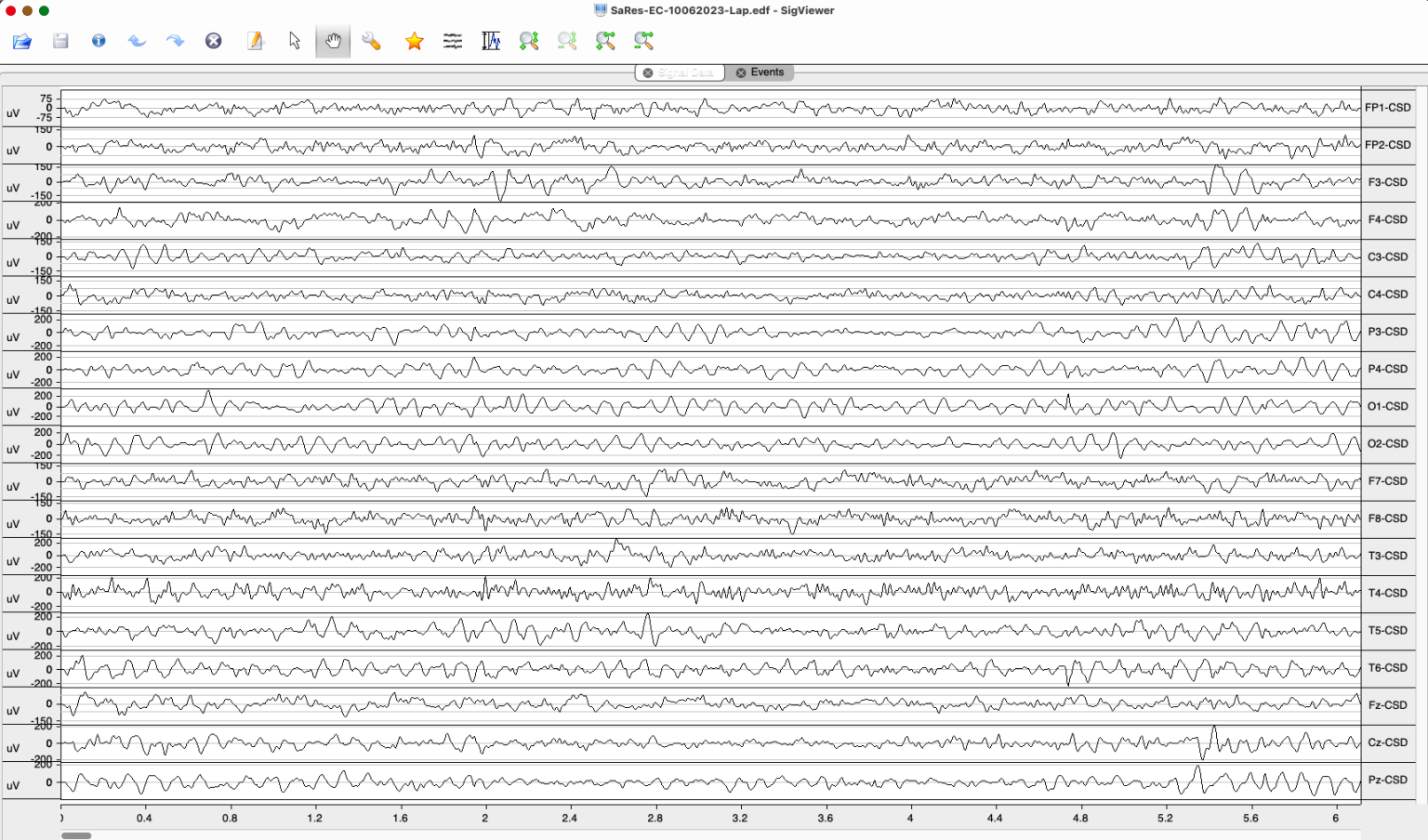 QEEG Brain Mapping - Peak Brain Institute