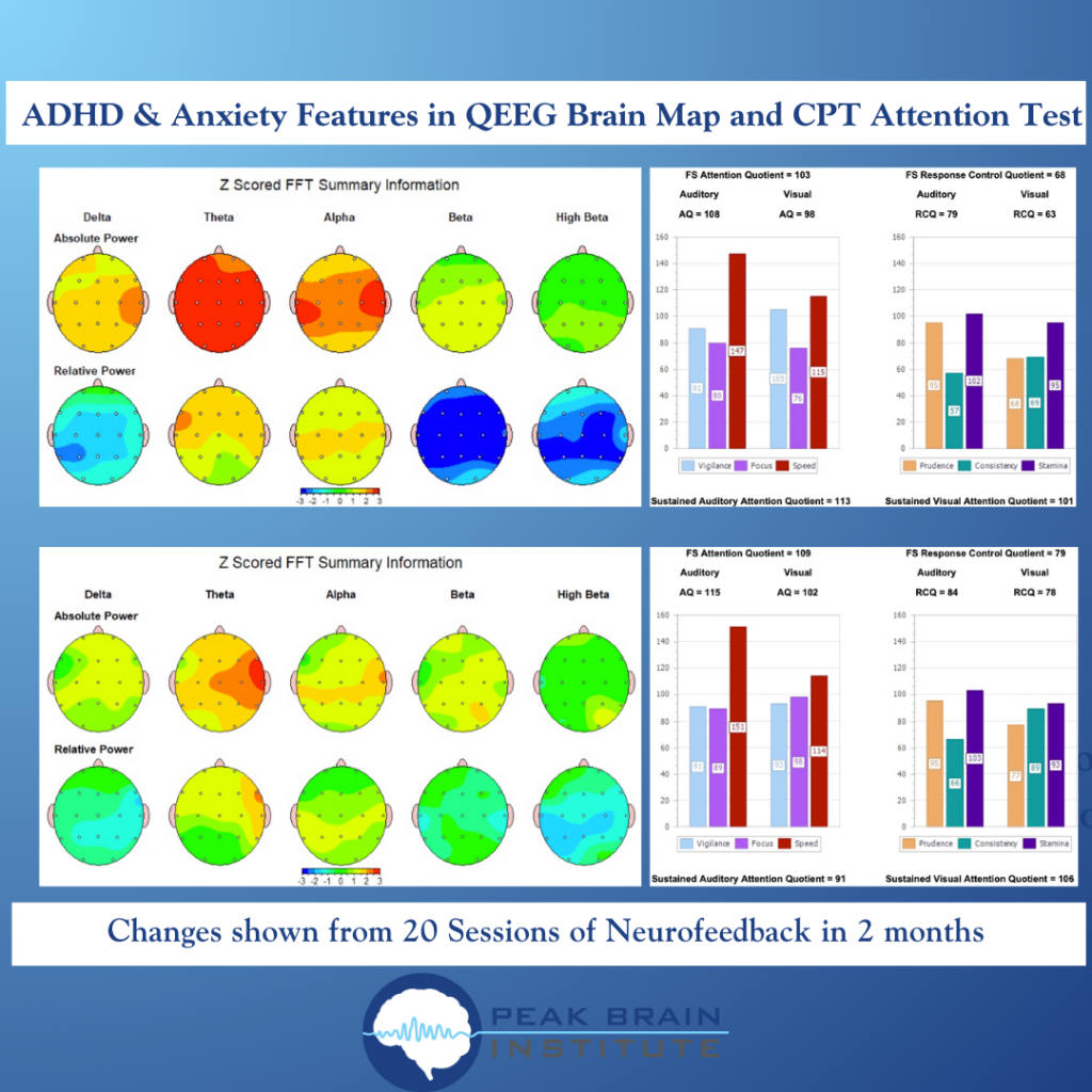 Unlock Your Potential: QEEG Brain Mapping & Neurofeedback Therapy
